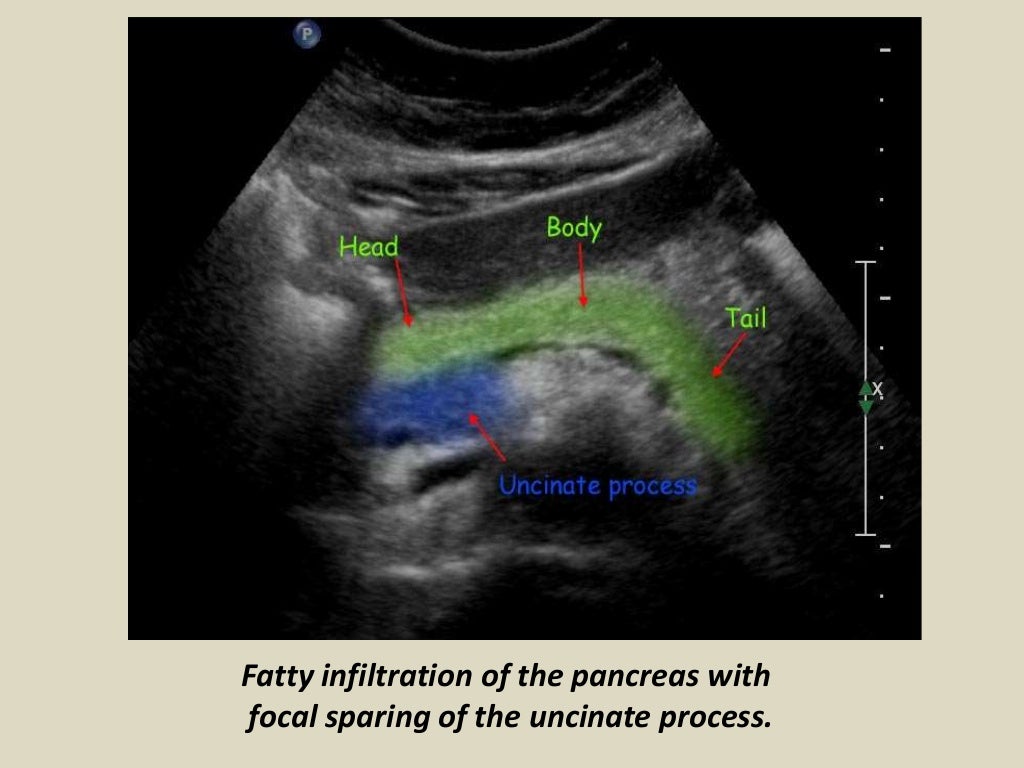 Presentation1, abdominal ultrasound anatomy.