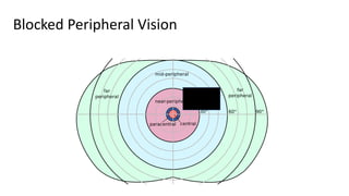 Peripheral Vision: A New Killer App for Smart Glasses | PDF | Eye and ...