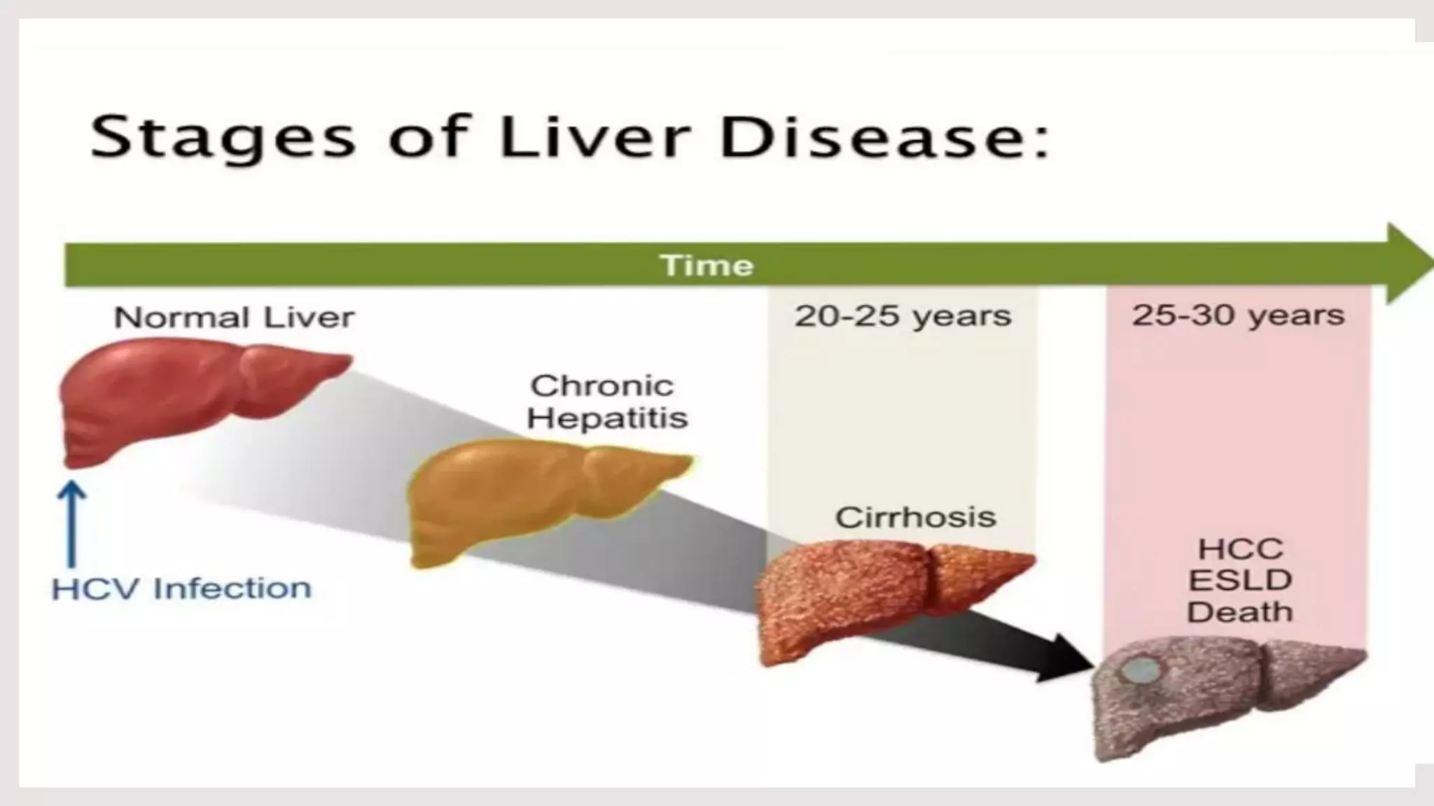 Hepatitis C virus , introduction, type ,pathogenesis, diagnosis ...