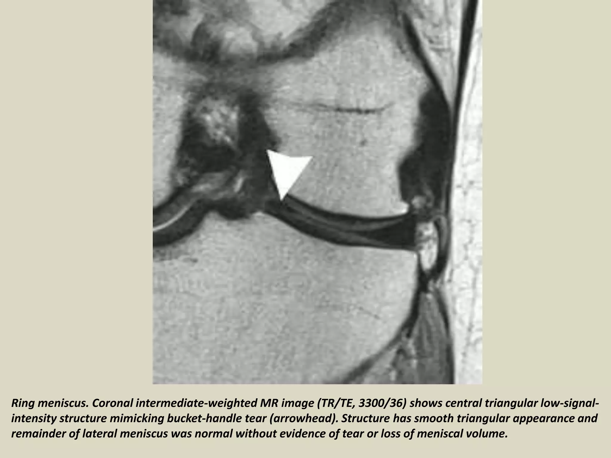 Presentation1, artifact and pitfalls of the knee, hip and ankle joints ...