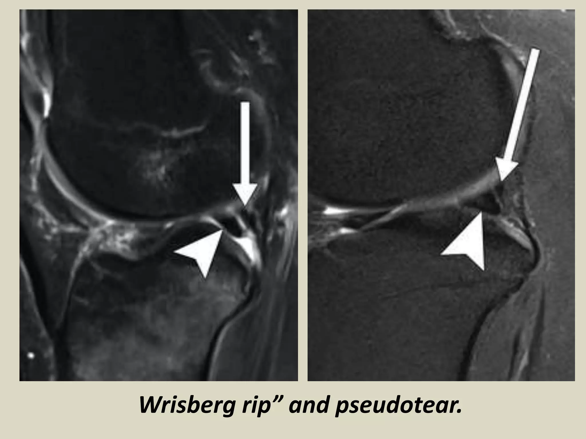 Presentation1, artifact and pitfalls of the knee, hip and ankle joints ...