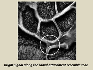 Presentation1, artifacts and pitfalls of the wrist and elbow joints. | PPT