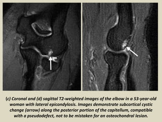 Presentation1, artifacts and pitfalls of the wrist and elbow joints. | PPT