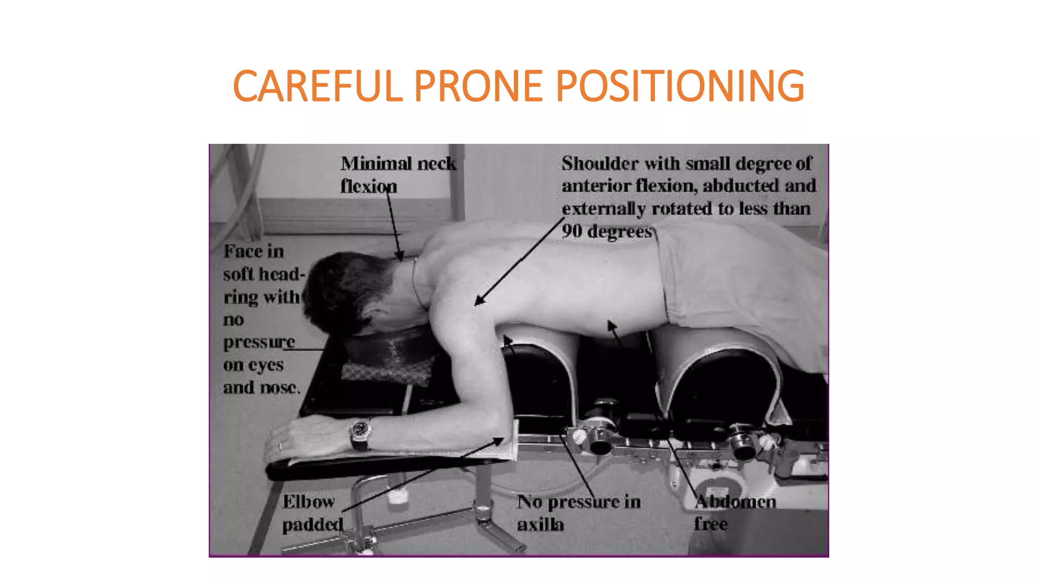 DIFFERENT PATIENT POSITIONING IN ANAESTHESIA | PPTX