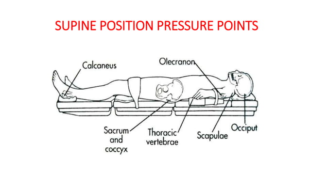 DIFFERENT PATIENT POSITIONING IN ANAESTHESIA | PPTX | Death, Injury, or ...