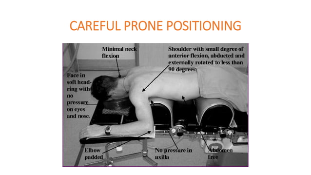 DIFFERENT PATIENT POSITIONING IN ANAESTHESIA | PPTX | Death, Injury, or ...