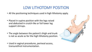Low Lithotomy Position