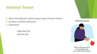Tremor -Overview of neurological earthquakes .pptx