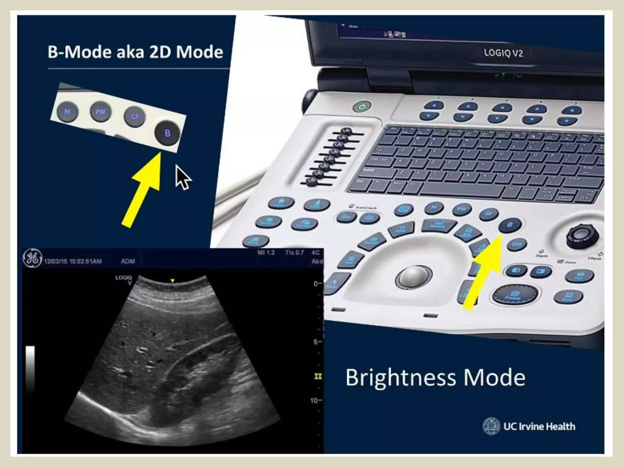 Presentation1, basic principle of ultrasound. | PPTX