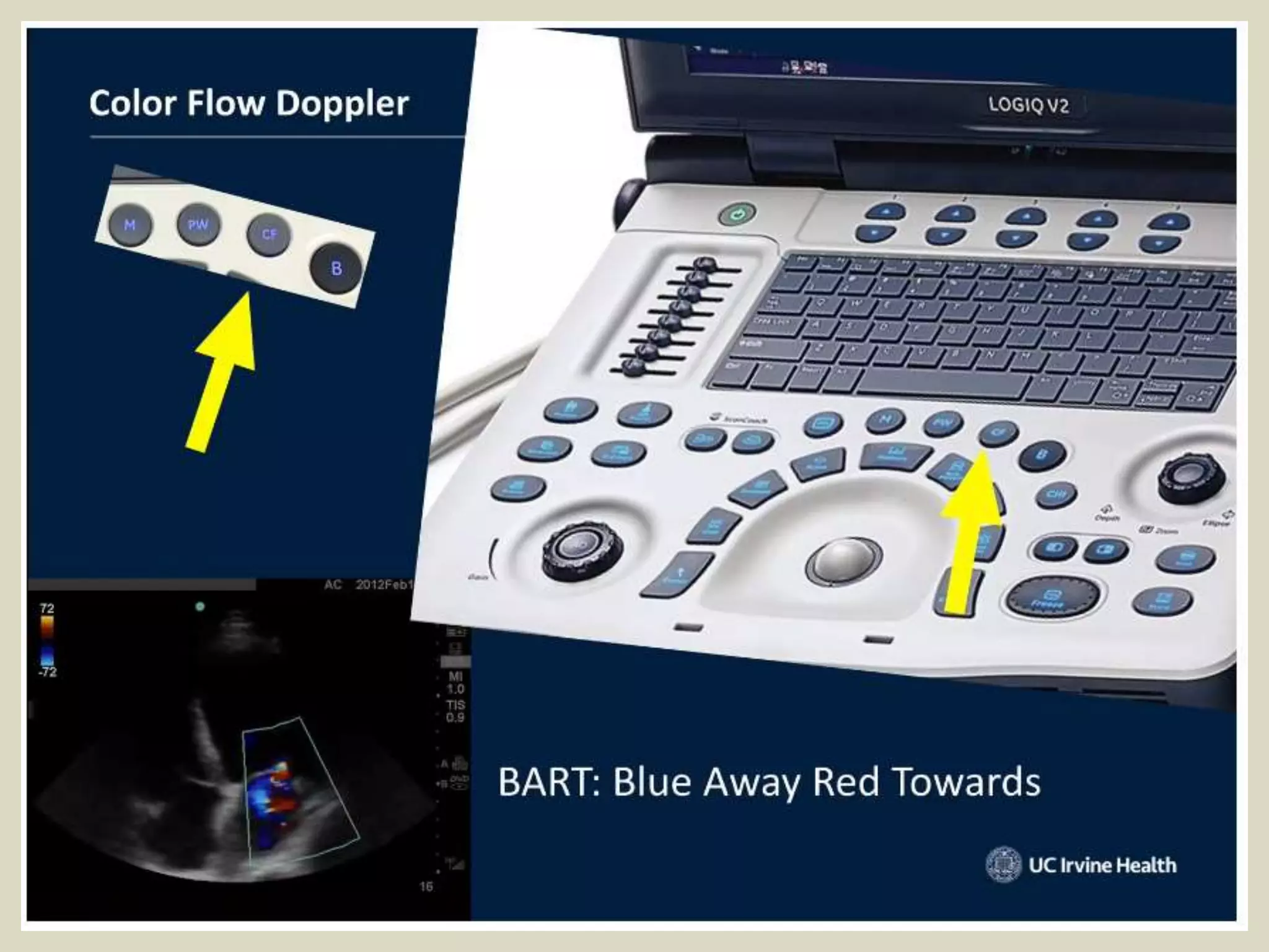 Presentation1, basic principle of ultrasound. | PPTX