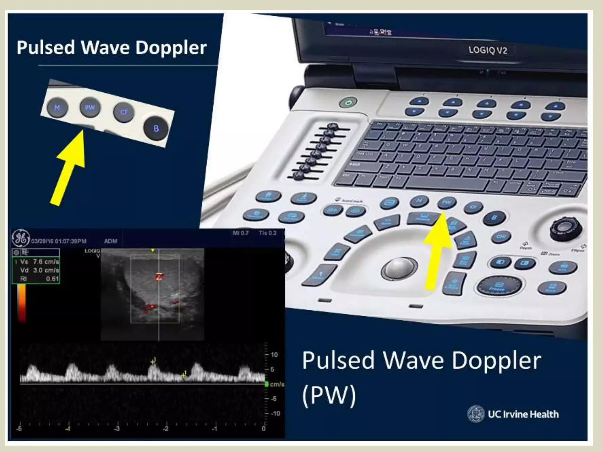 Presentation1, basic principle of ultrasound. | PPTX