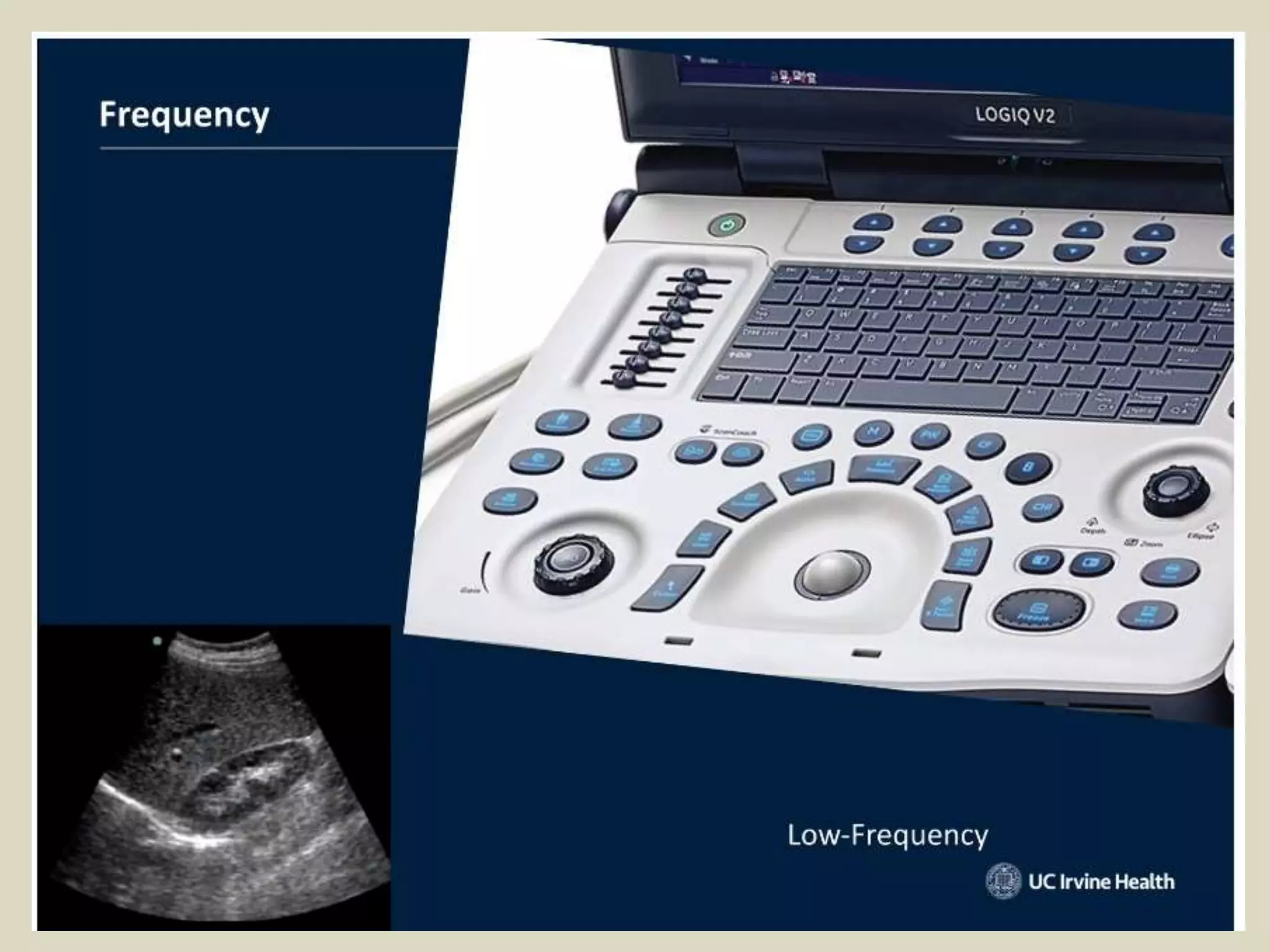 Presentation1, basic principle of ultrasound. | PPTX