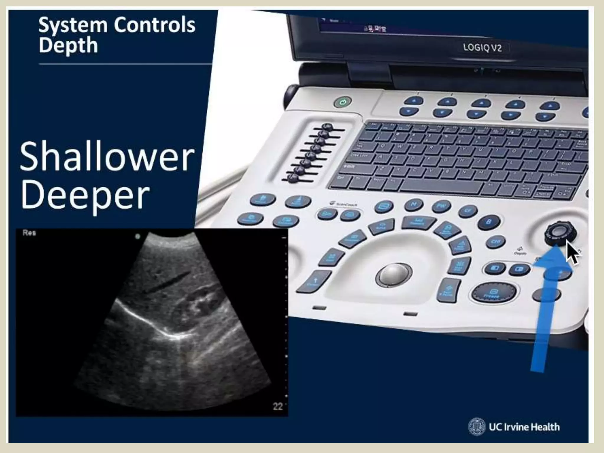 Presentation1, basic principle of ultrasound. | PPTX