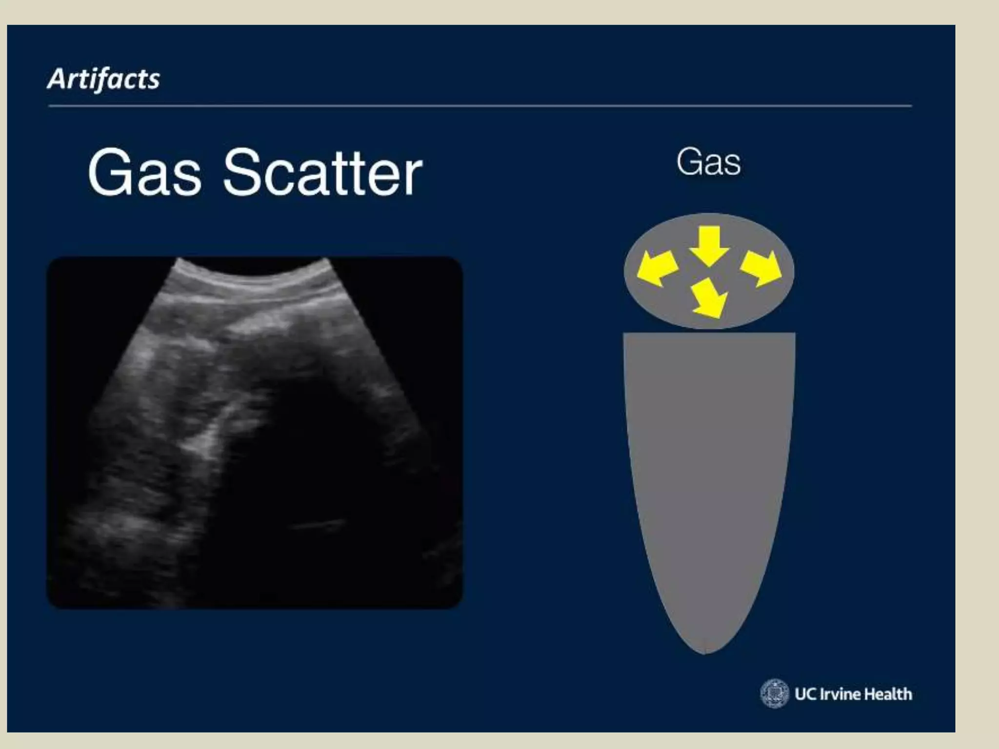 Presentation1, basic principle of ultrasound. | PPTX