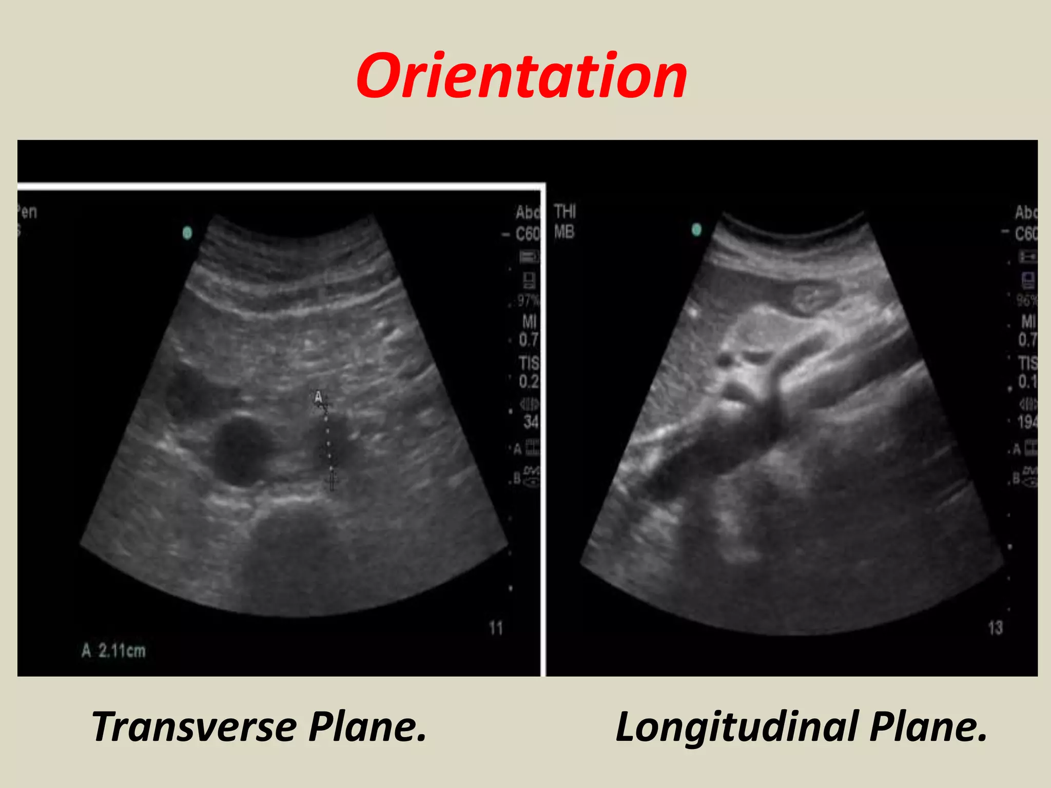 Presentation1, basic principle of ultrasound. | PPTX
