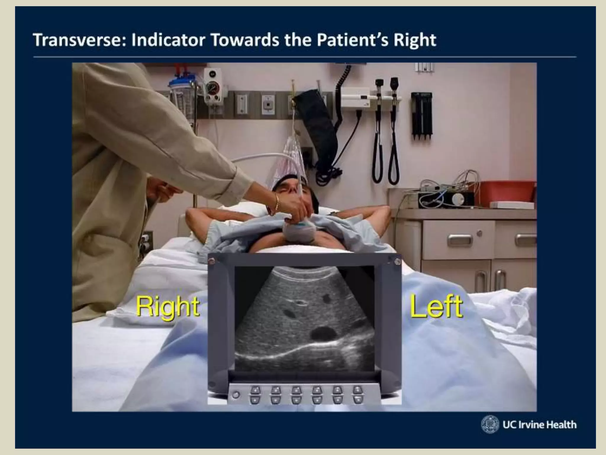 Presentation1, basic principle of ultrasound. | PPTX