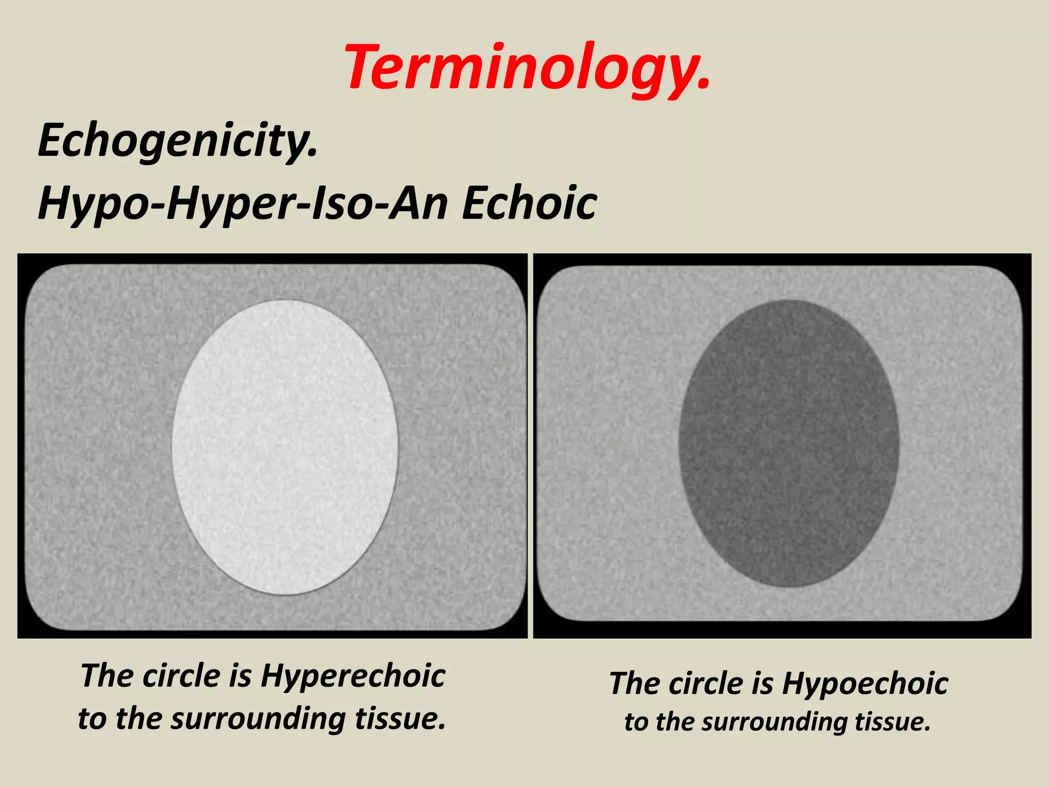 Presentation1, basic principle of ultrasound. | PPTX