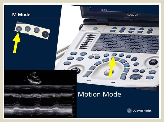 Presentation1, basic principle of ultrasound. | PPTX