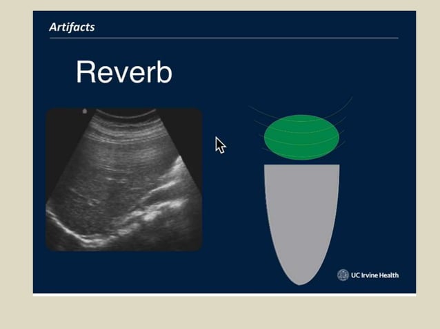 Presentation1, basic principle of ultrasound. | PPTX