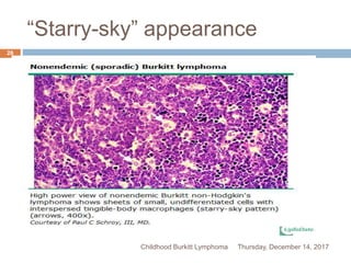 BURKITTS LYMPHOMA | PPT