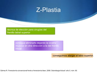 Cirugia Estetica Gingival | PPTX