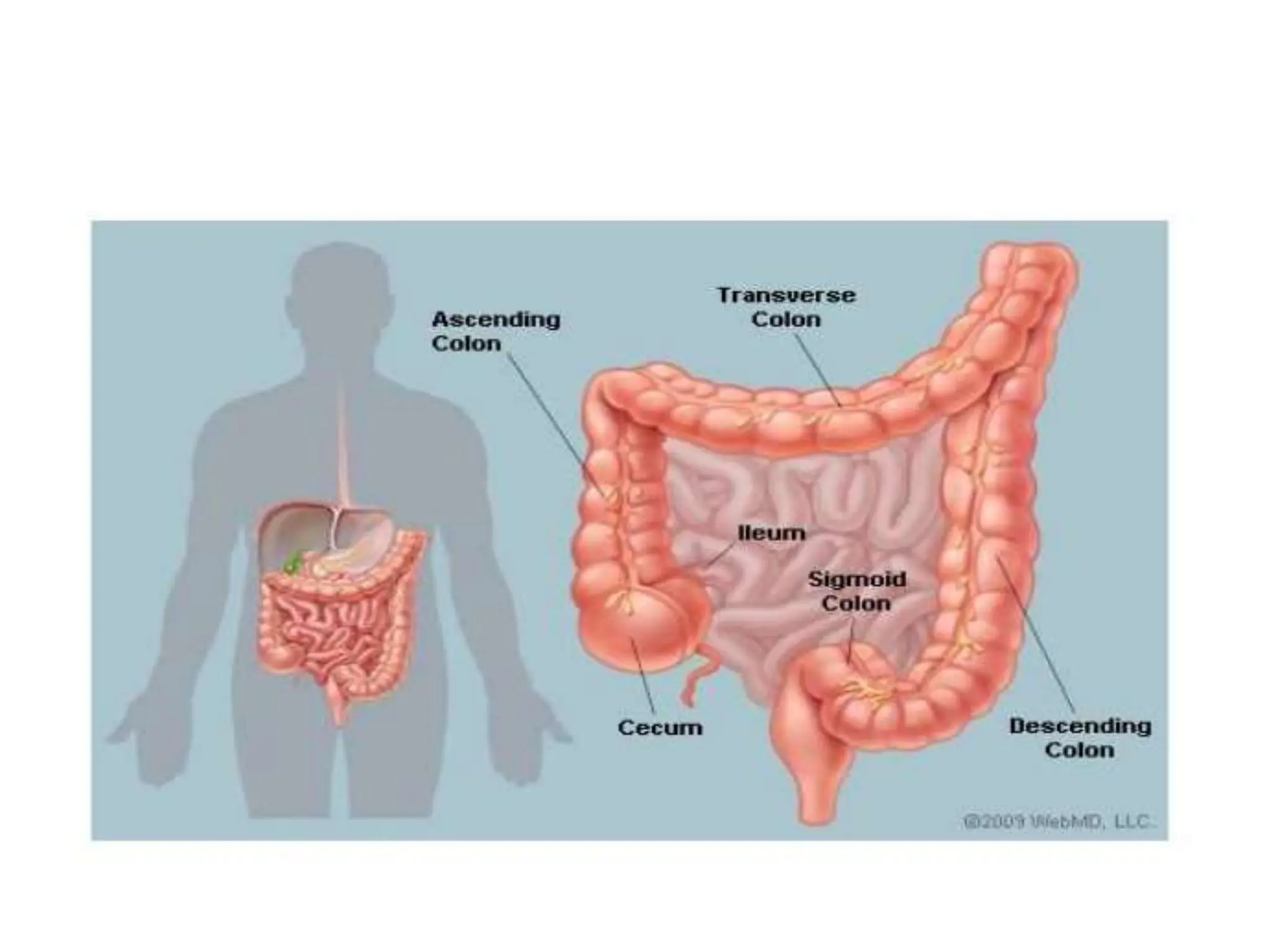 COLOSTOMY CARE AND ROLE OF NURSES IN MANAGEMENT IN PATIENT WITH ...