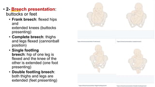 Normal Labor and delivery , brief lecture | PPTX