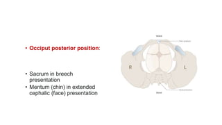 Normal Labor and delivery , brief lecture | PPTX
