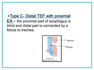 Proximal Vs Distal Esophagus