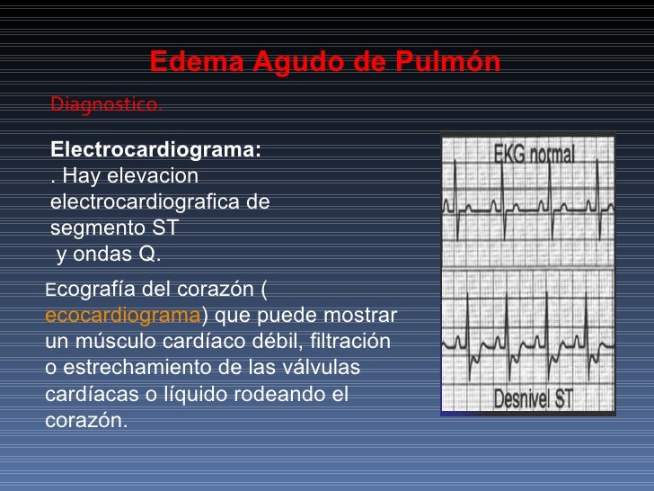 Presentation1 EDEMA AGUDO DEL PULMON