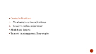 Presentation (1) ent.pptx