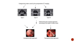 Presentation (1) ent.pptx