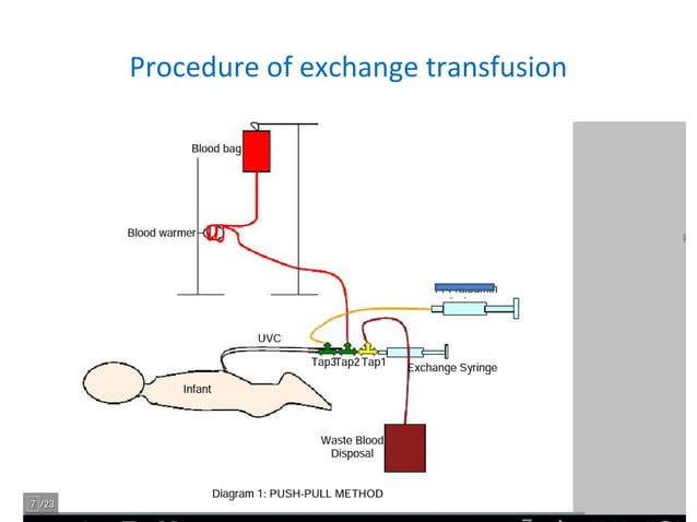 Presentation1 et | PPT