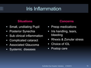 Presentation 1 exfoliation and uveitis | PPTX