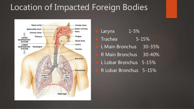 Foreign body aspiration in children