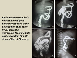 Presentation1, film readiing for barium studies. | PPT