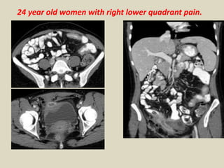 Presentation1, film readiing for barium studies. | PPT