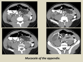 Presentation1, film readiing for barium studies. | PPT