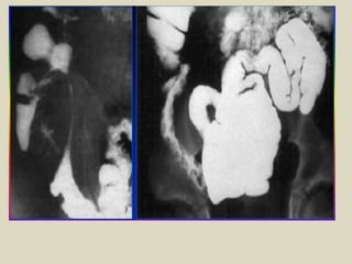 Presentation1, film readiing for barium studies. | PPT