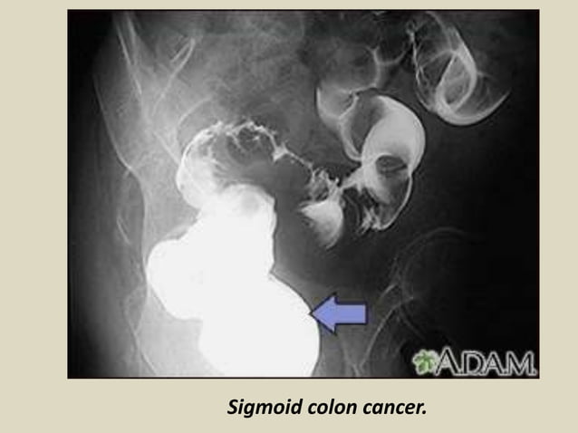 Presentation1, film readiing for barium studies. | PPT