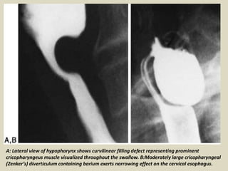 Presentation1, film readiing for barium studies. | PPT