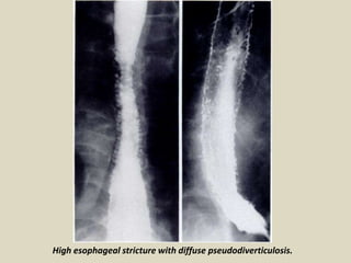 Presentation1, film readiing for barium studies. | PPT