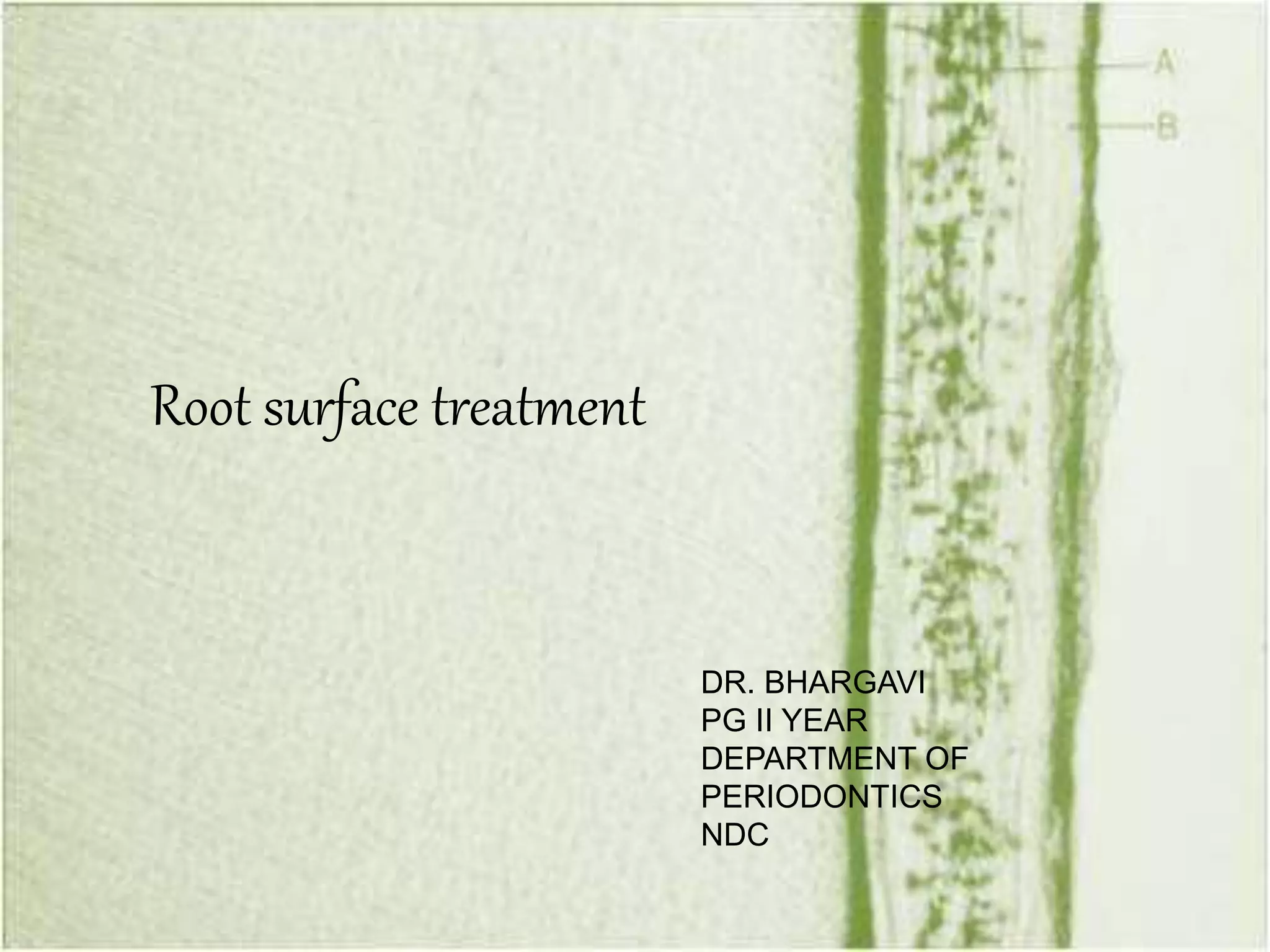 root surface treatment in periodontics | PPTX