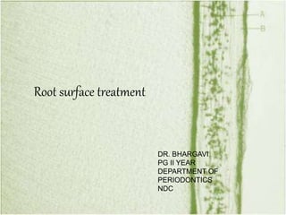 root surface treatment in periodontics | PPTX