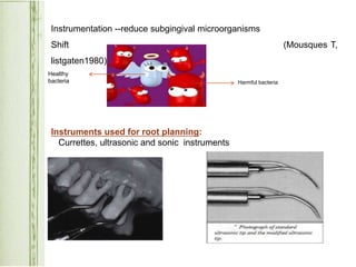 root surface treatment in periodontics | PPTX