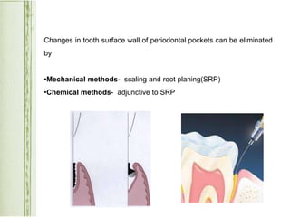 root surface treatment in periodontics | PPTX