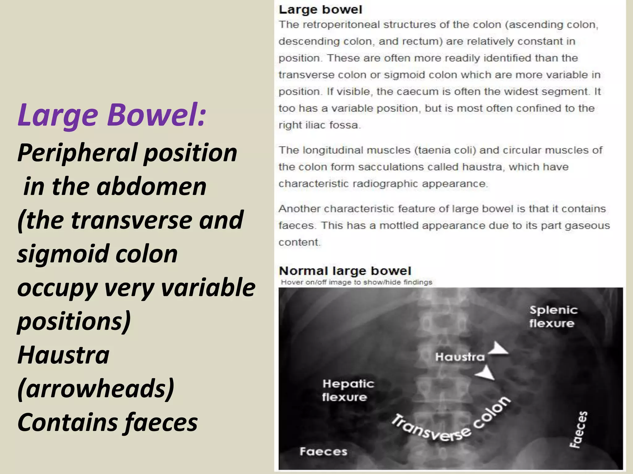 Presentation1, interpretation of x ray of the abdomen. | PPTX