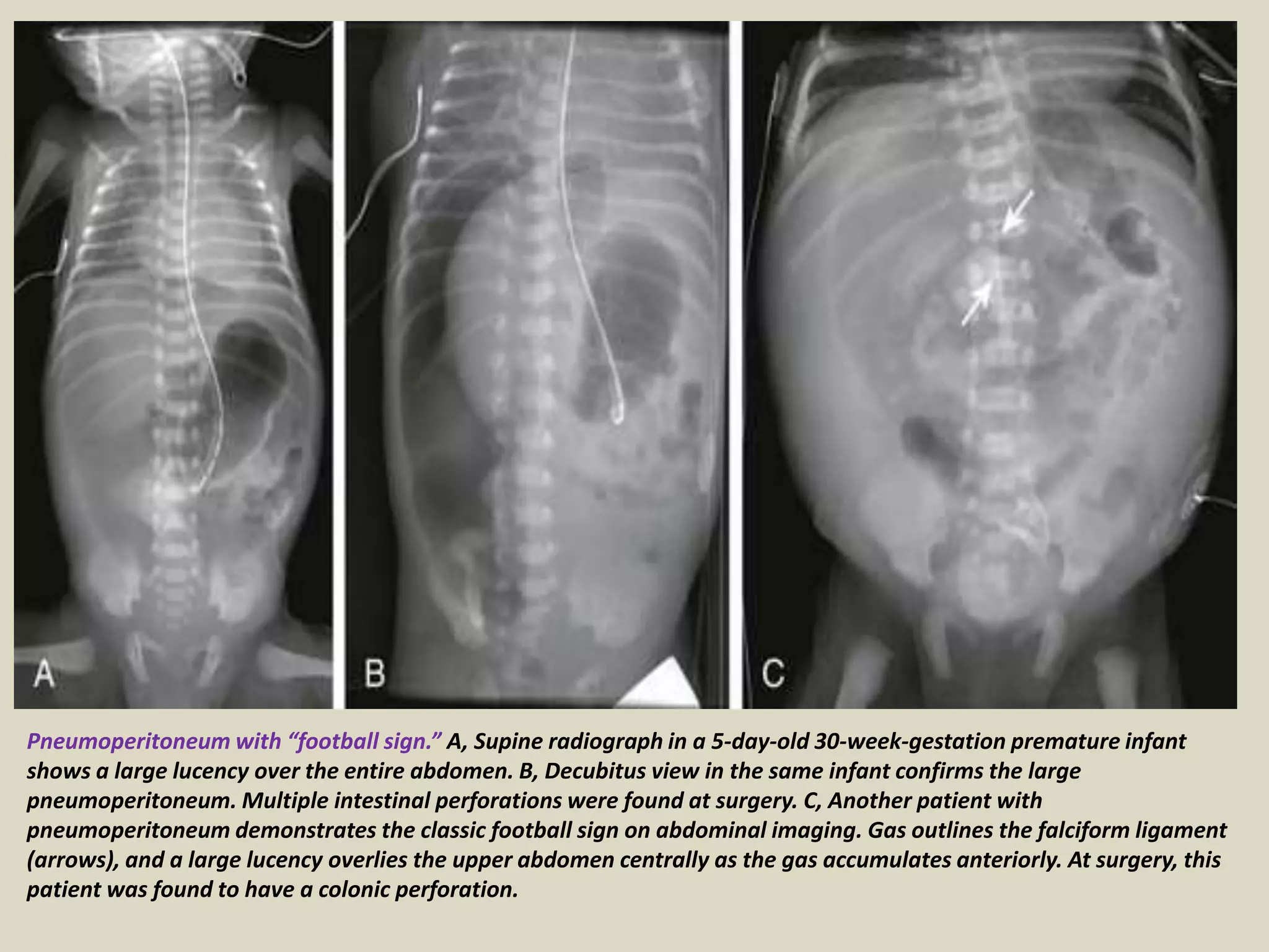 Presentation1, interpretation of x ray of the abdomen. | PPTX