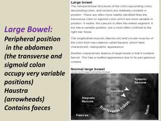 Presentation1, interpretation of x ray of the abdomen. | PPTX