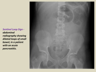 Presentation1, interpretation of x ray of the abdomen. | PPTX